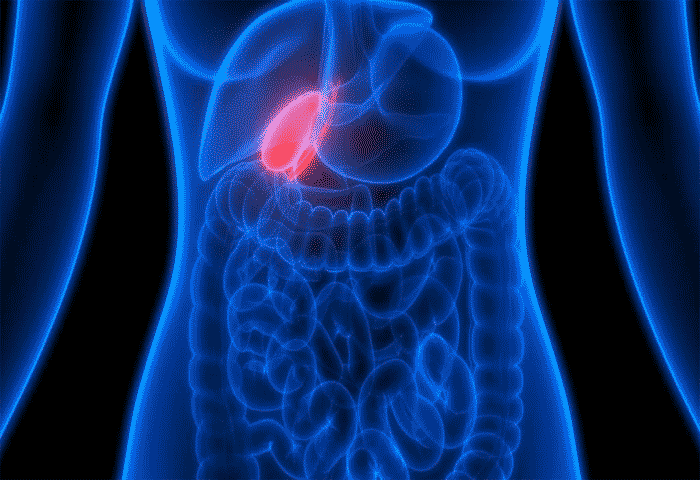 Gallbladder | പിത്താശയത്തിലെ കല്ലുകള്‍: ലക്ഷണങ്ങളും ചികിത്സയും ...